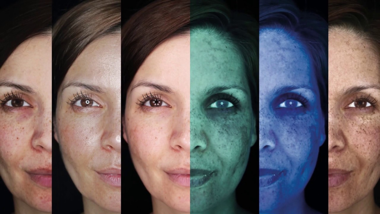 Observe 520X Huidanalyse – Huidkliniekpuur